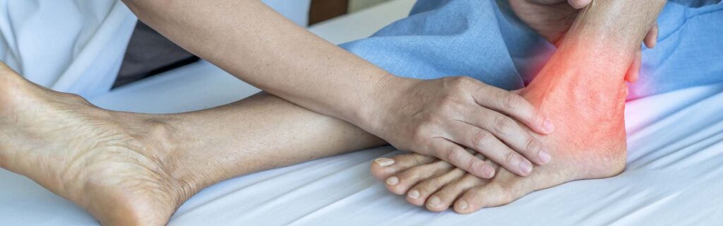 OCD Treatment: Florida Foot & Ankle Specialists