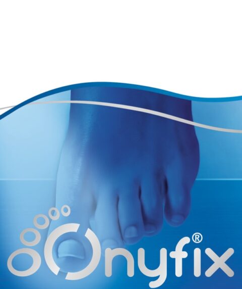 Onyfix Nail Correction in Bradenton: Pain-Free Toenail Care